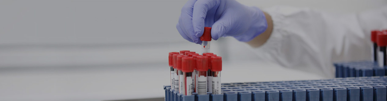 Best Diagnostic Centre In Mathura | Pathology Laboratory In Agra ...